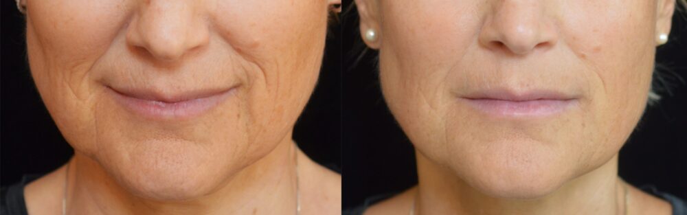 Juläine / PLLA " The Faculty