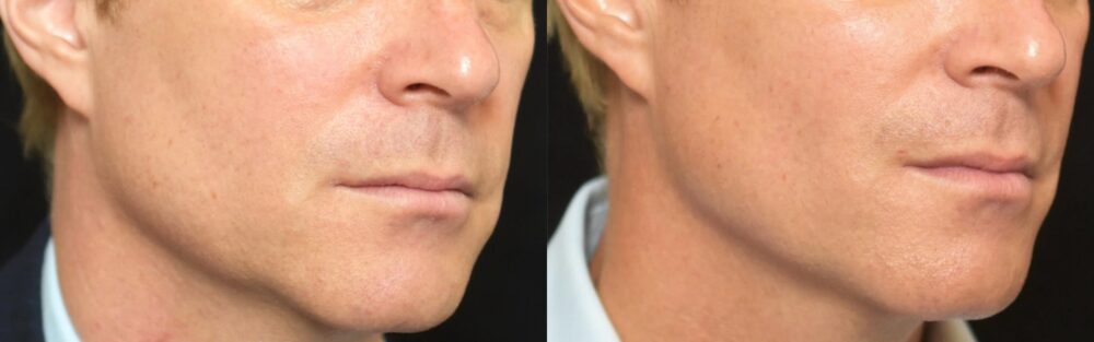 Juläine / PLLA " The Faculty