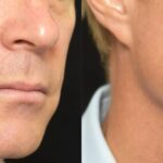 Juläine / PLLA " The Faculty