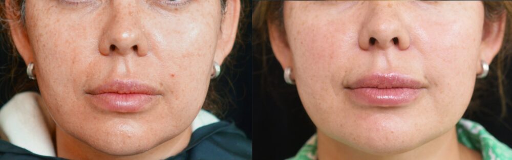 Juläine / PLLA " The Faculty