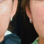 Juläine / PLLA " The Faculty